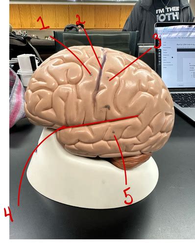 Lab Practical Nerves Flashcards Quizlet