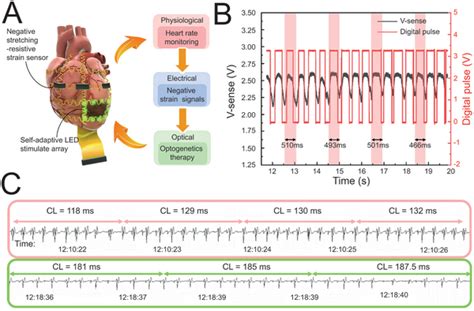 Self‐adaptive System For Closed‐loop Control Of Vt A Schematic