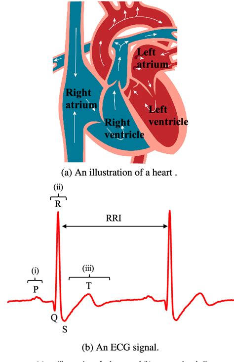Figure 1 From Ecg Signal Reconstruction Via Doppler Sensor By Hybrid Deep Learning Model With