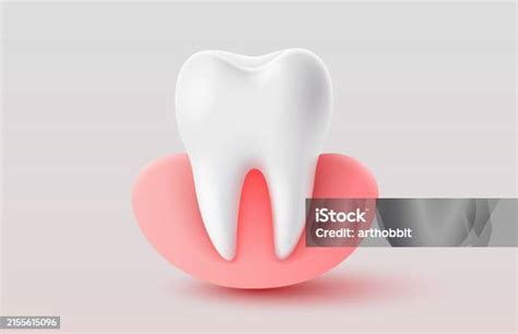 잇몸과 치아 밝은 배경에 치아의 3d 그림 벡터 일러스트 레이 션 이빨에 대한 스톡 벡터 아트 및 기타 이미지 이빨 3차원 형태 치통 Istock