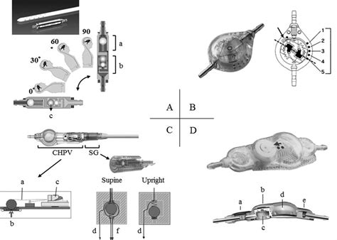 Shunt Valve Gcse Biology At Lucy Dean Blog