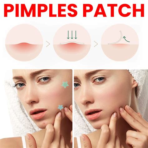 Jaysuing Pimple Patch Lighten Pimple Spots Repair Skin Acne Marks
