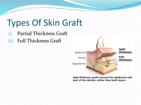Skin Grafts And Skin Flaps Pptx