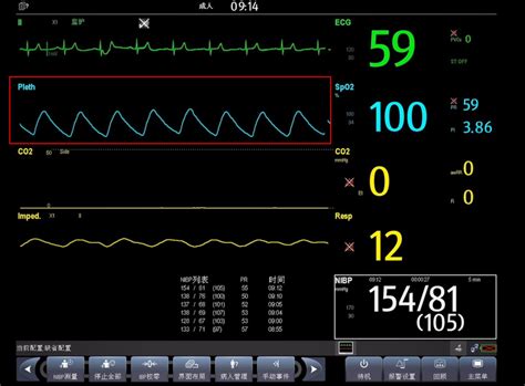 Ppg Waveform Examples Of Patients With Hypertension Download Scientific Diagram