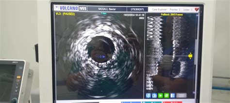 ЦЭРГИЙН ТӨВ ЭМНЭЛЭГТ АНХ УДАА ЗҮРХНИЙ ТИТЭМ СУДСАН ДОТУУРХ ЭХО ОНОШИЛГОО ХИЙЛЭЭ ЦЭРГИЙН ТӨВ