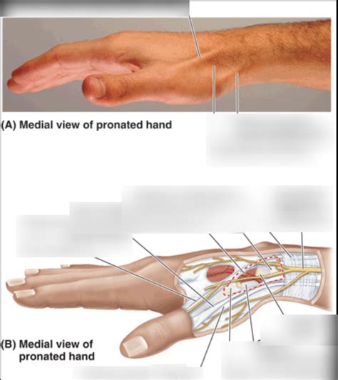 Anatomical Snuff Box Diagram Quizlet