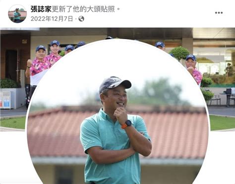 張誌家曾喊「後腦莫名痛」 男人40好發偏頭痛！醫曝兩大異常恐不對勁
