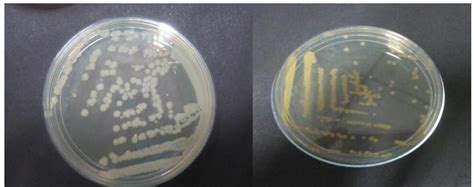 2 Single Colony Isolation On Nutrient Agar Plates A White
