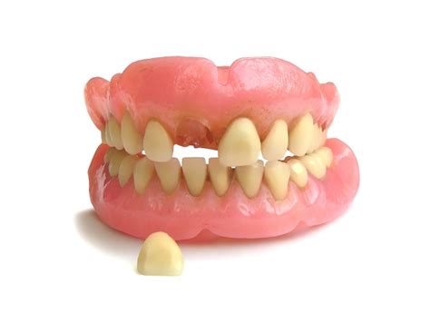Partial Denture Options For Replacing Missing Teeth Hemet Dental