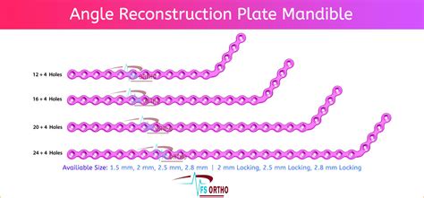Angle Reconstruction Plate Mandible Introduction Fsortho