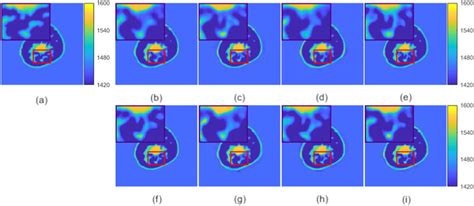 The sound speed image reconstruction results m s¹ on noise free Download Scientific