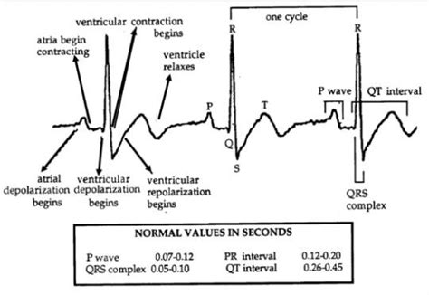 Normal Waves And Intervals Pr Interval P Wave Saving Lives
