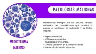 Citología De Líquidos Y Derrames Patologías Benignas Y Malignas Pdf