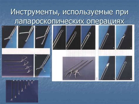 Эндоскопические манипуляции и эндоскопическая хирургия - online ...