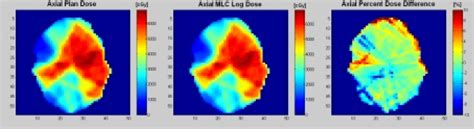 Comparison Of The Dose Distributions In An Axial Plane Between Those Download Scientific