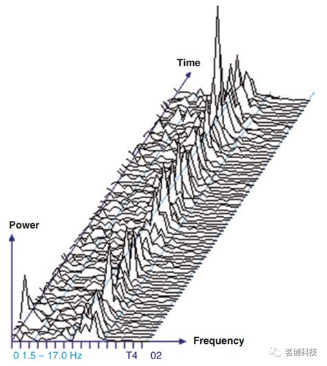 脑电信号分析 知乎