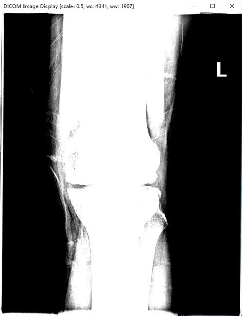 Render Error When Dx With Voi Lut Sequence 00283010 Tag · Issue 949
