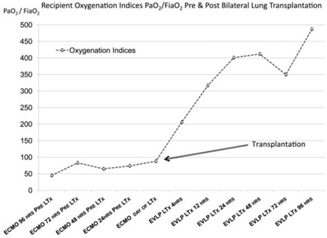 Oxygenation P F Ratios During ECMO And After Bilateral Sequential LTx Download Scientific
