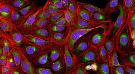 The Financial Paradox Of Developing An Advanced Cell Culture Model