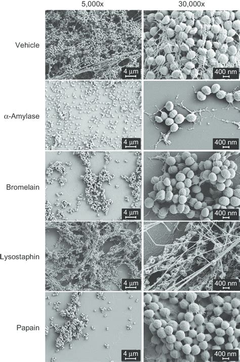 Visualization Of Dispersal Enzyme Effect On Staphylococcus Aureus Download Scientific Diagram