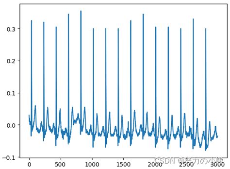Mimic Iv波形数据库之心电信号如何从mimic4数据中找到心电数据 Csdn博客 Mimic Iv波形数据库之心电信号如何从mimic4数据中找到心电数据 Csdn博客