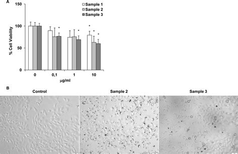 Effects Of Different Types Of Fe Doped N Tio 2 Sample 1 2 And 3 Download Scientific Diagram
