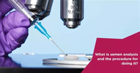 Semen Analysis Procedure Semen Analysis Sperm Count