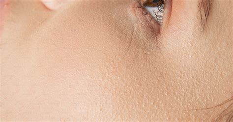 하얀 병을 들고 눈에 떨어지는 점안액을 들고 있는 여성의 손을 클로즈업합니다 사진 Unsplash의 망막 이미지