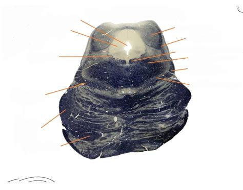 Caudal Midbrain Myelin Stain Cross Section Quiz