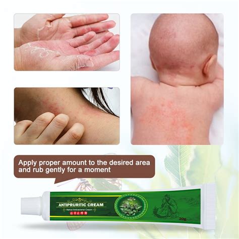 Ointment Contact Dermatitis