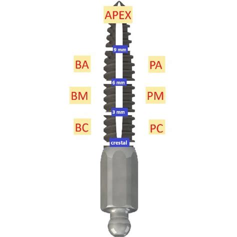 Cawood Howell Classification 23 Of The Maxillary Alveolar Ridge Download Scientific Diagram