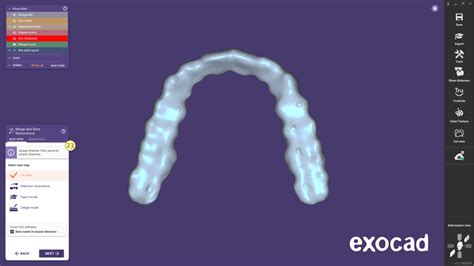 Bite Splint Exocad