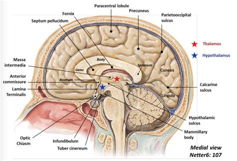 Hypothalamic Sulcus