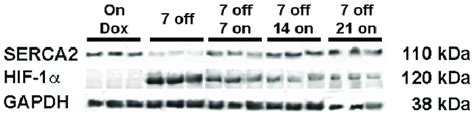 Western Blot Of Hif 1a Ppn And Serca Levels Following Doxycycline