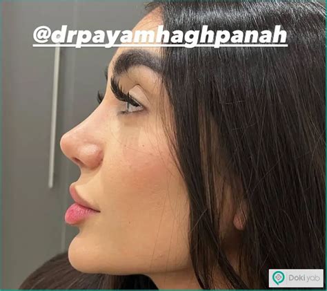 عمل بینی فانتزی عروسکی برترین پزشکان هزینه دقیق جراحی