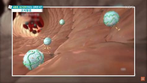 고지혈증 Ldl나쁜 콜레스테롤 Hdl좋은 콜레스테롤 Tg중성지방이란 단어 정리 네이버 블로그