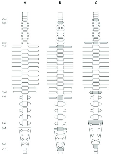 Schematic Representation Of The Interregional Effects Of Homeotic Download Scientific Diagram