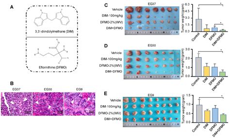 Administration Of Combination Dimdfmo In An Escc Pdx Model Showed