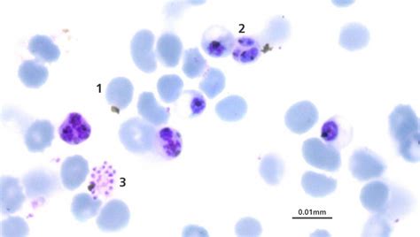 GitHub Gabbygab1233 Malaria Infected Cell Detection