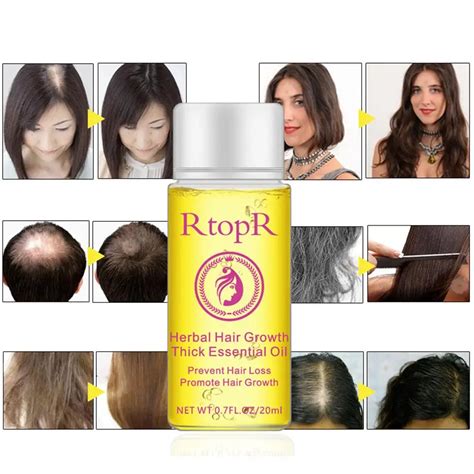 20 мл масло для волос эссенция для быстрого роста волос облысение натуральные травяные мощные