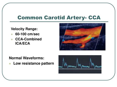Ppt Extracranial Cerebrovascular Evaluation Powerpoint Presentation