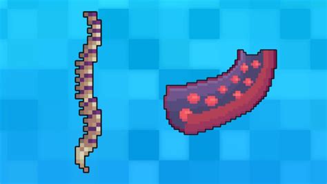 Neurogenic Vs Vascular Claudication Spinal Stenosis Geeky Medics