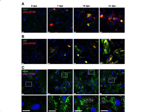 α Synuclein Inclusions In Msa Infected Astrocytes Are Ubiquitinated And Download Scientific