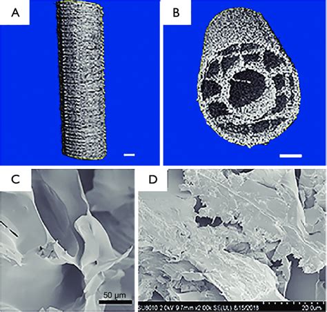 Microstructure And Morphology Of 3d Pla Ha Scaffolds Ab μct Scar