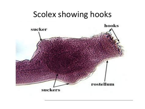 Echinococcus Granulosus Scolex