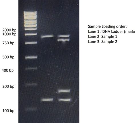 What Is These Bands Indicated Female Or Male Chegg Com