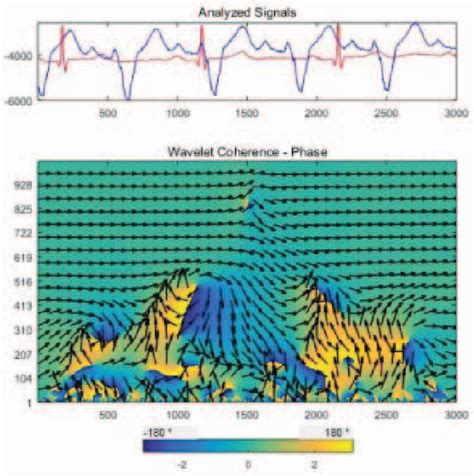Figure 1 From Ecg Signal Analysis Using Wavelet Coherence And S Transform For Classification Of
