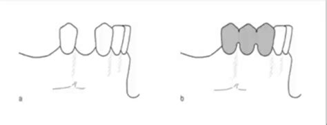 Patient Orientated Treatment Planning And Sequencing Flashcards Quizlet