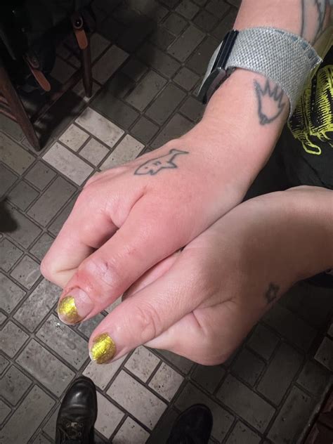 Dog Biteinfection Rmedicalgore