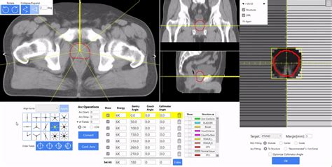 Ezfluence Radformation